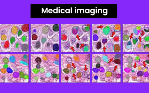 What Is Panoptic Segmentation and It's Useful Applications